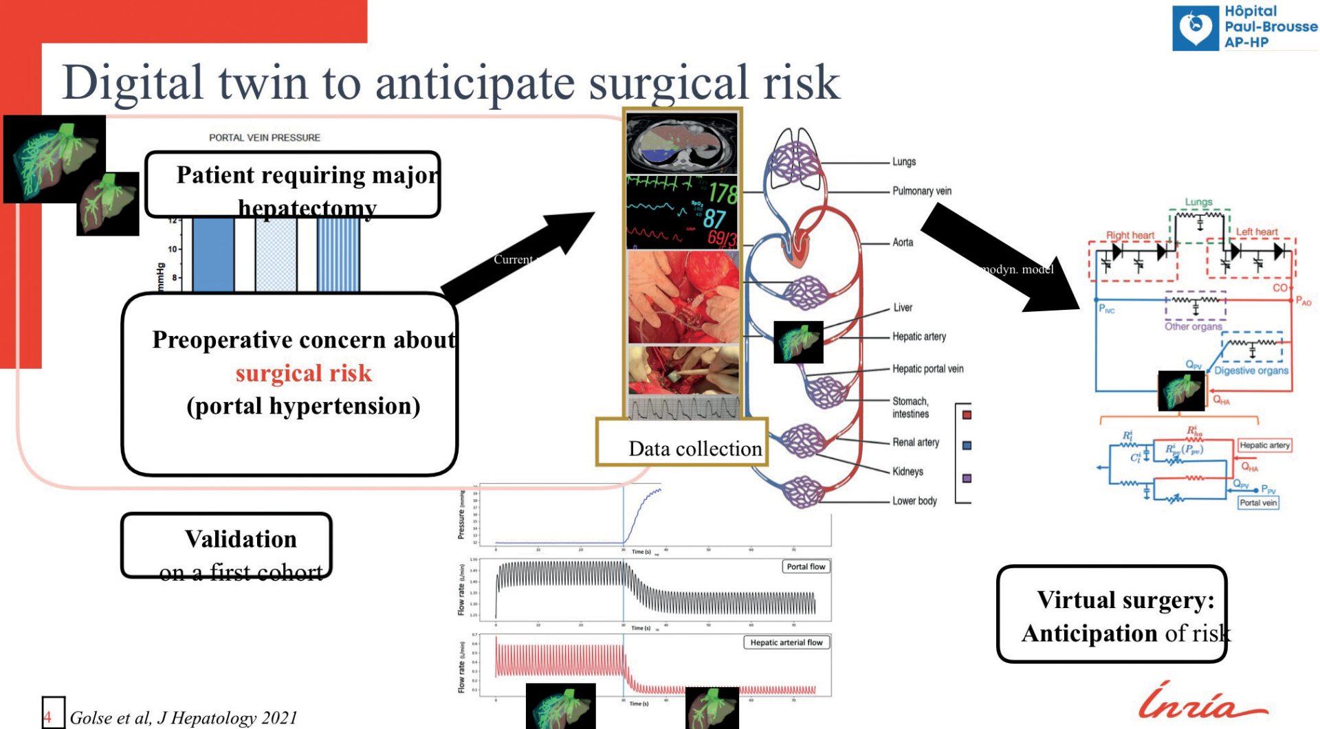 SANTE – Inria : le jumeau numérique, virage décisif pour la santé